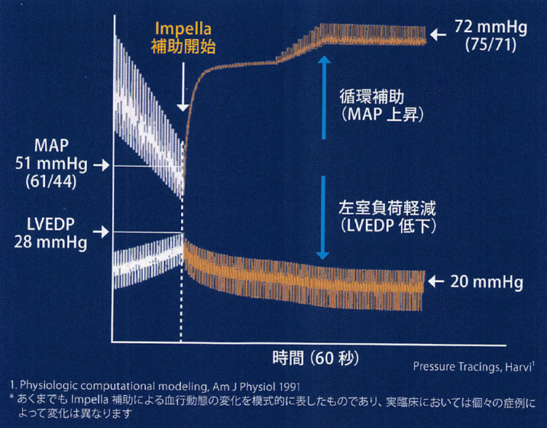 補助循環 IMPELLA― 治療目標と効果 ― | CEじゃーなる