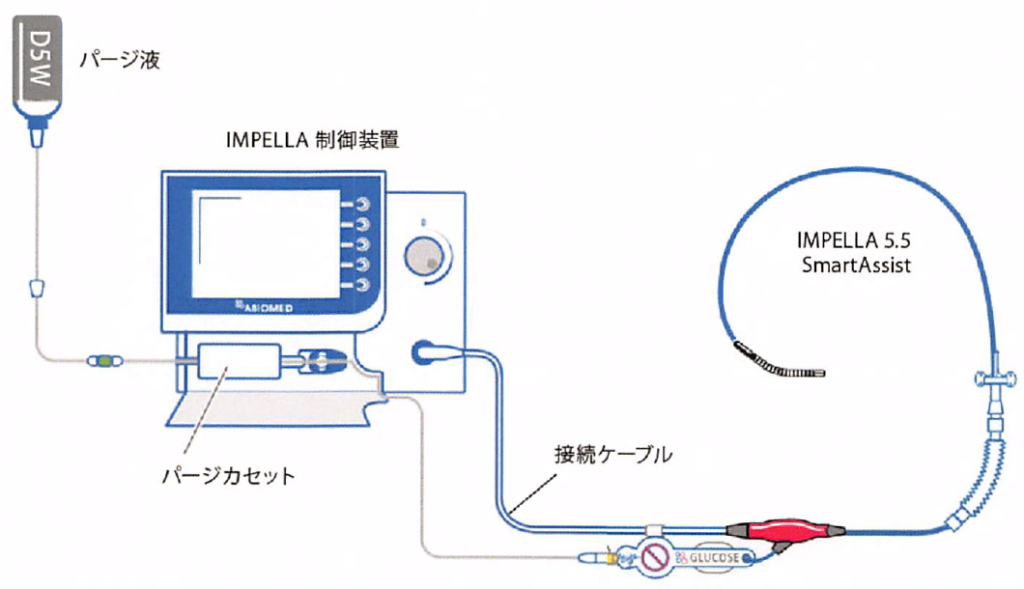 補助循環 IMPELLA — デバイス紹介— | CEじゃーなる