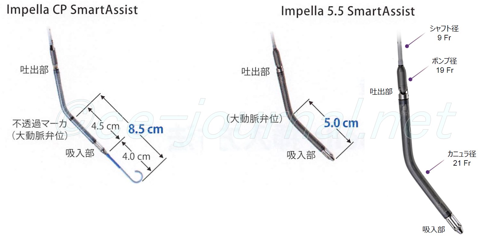 補助循環 IMPELLA — デバイス紹介— | CEじゃーなる