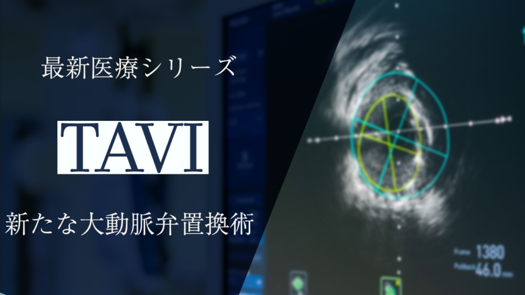 TAVIとは — 新たな大動脈弁置換術 — | CEじゃーなる
