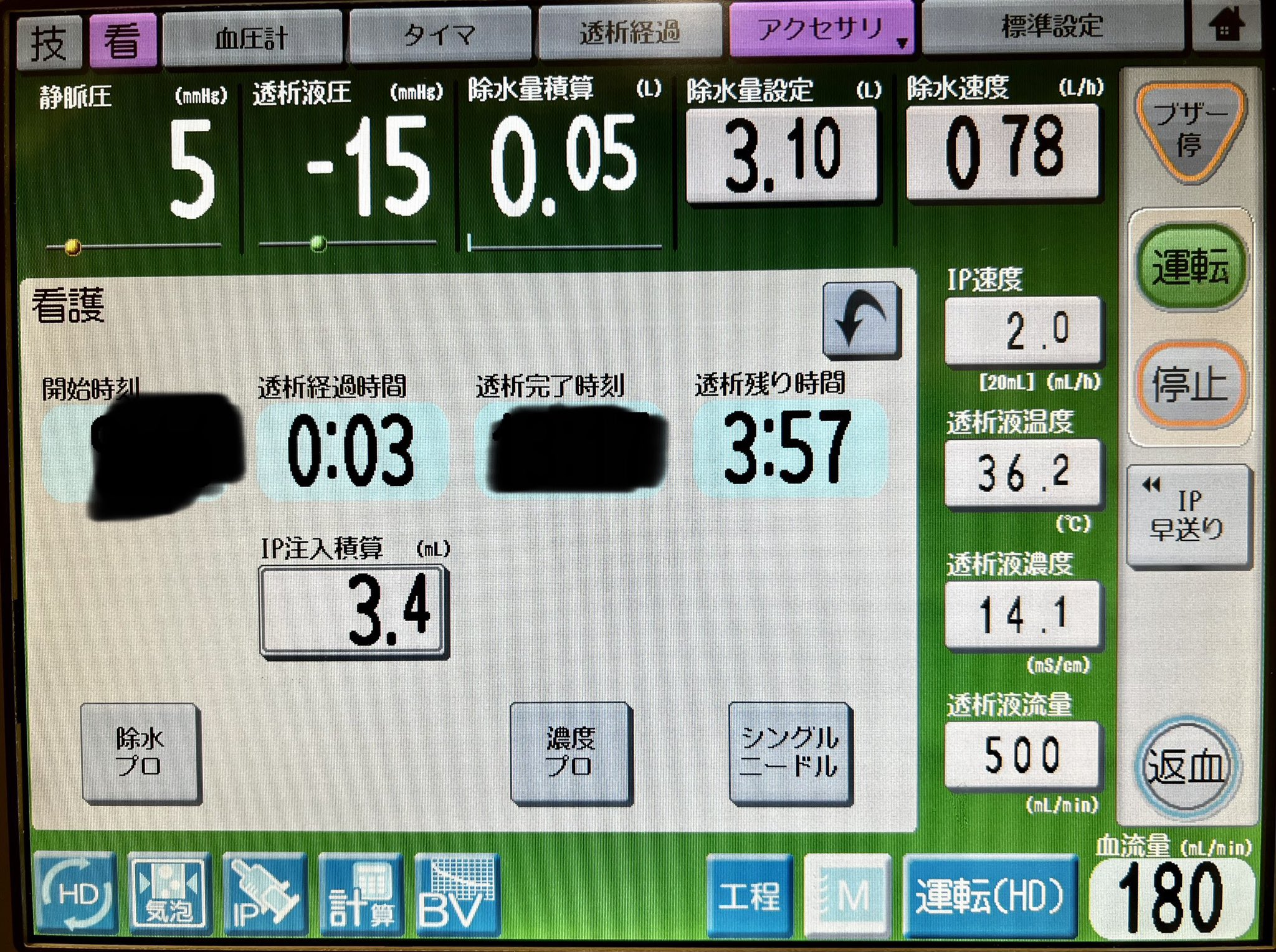 透析液圧と除水の関係 あなたはどう考える？ | CEじゃーなる