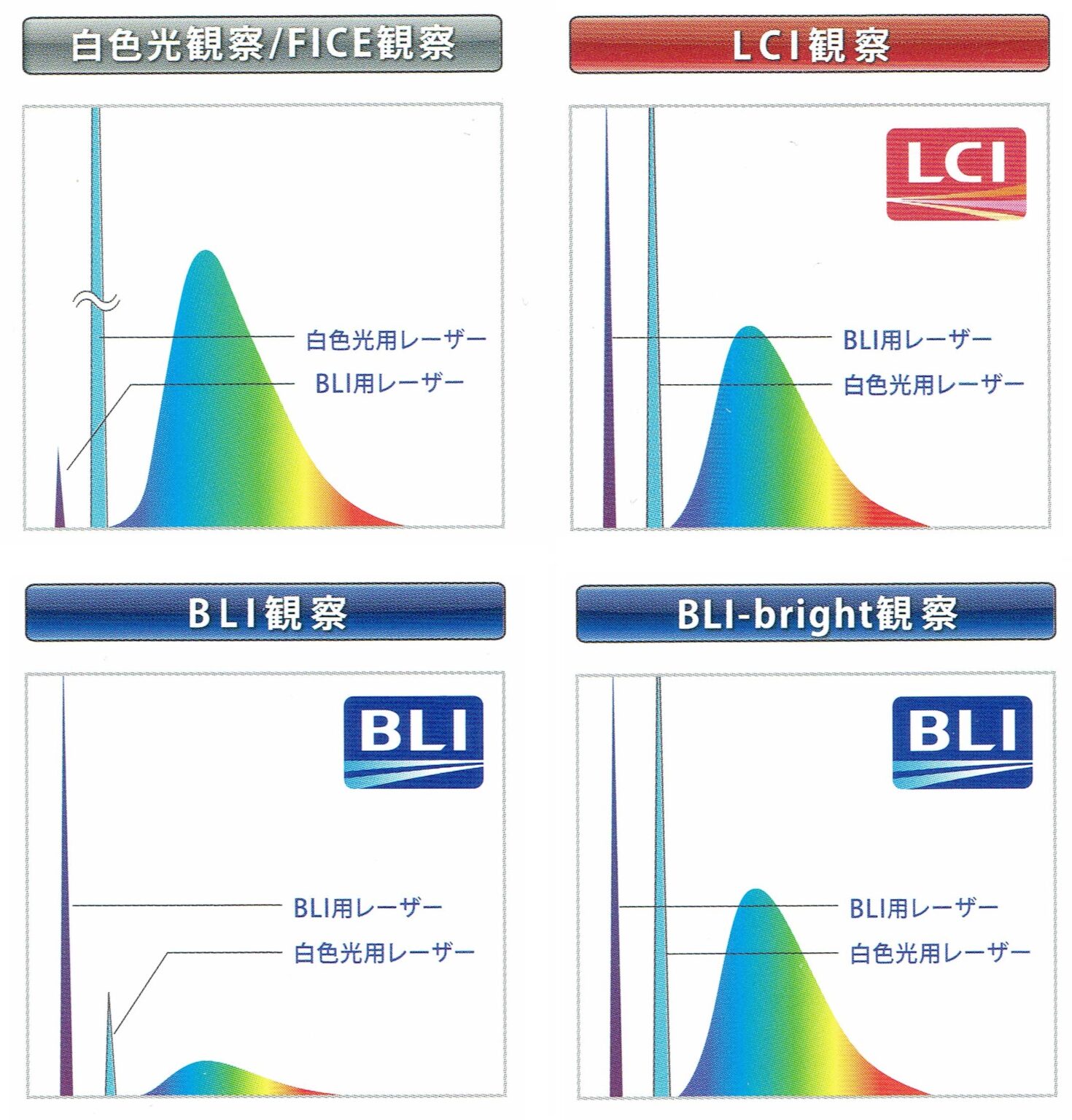 内視鏡の特殊光観察（IEE）について FUJIFILM編 | CEじゃーなる