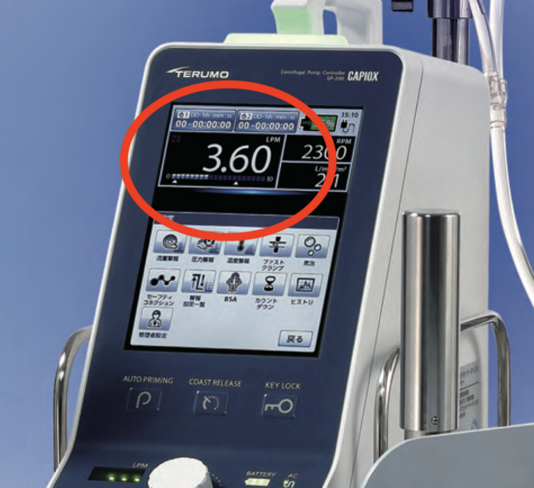 ECMO のシステム構成と周辺機器 それぞれの役割 | CEじゃーなる
