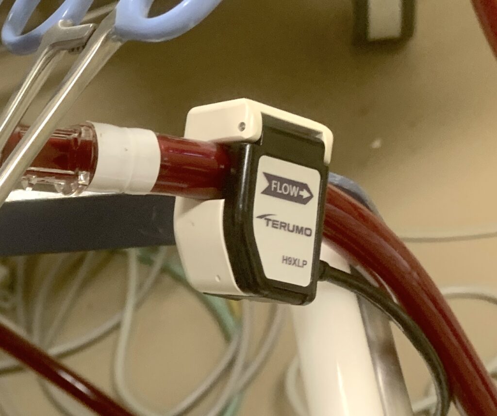 ECMO のシステム構成と周辺機器 それぞれの役割 | CEじゃーなる