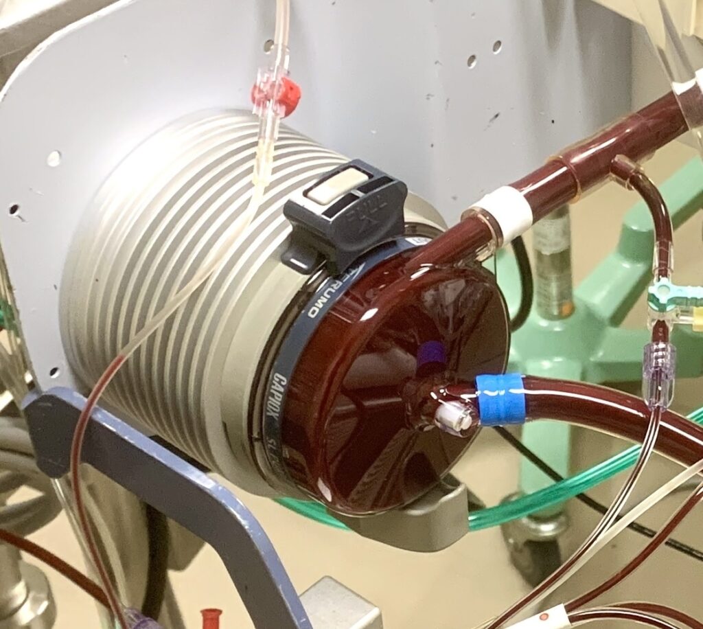ECMO のシステム構成と周辺機器 それぞれの役割 | CEじゃーなる