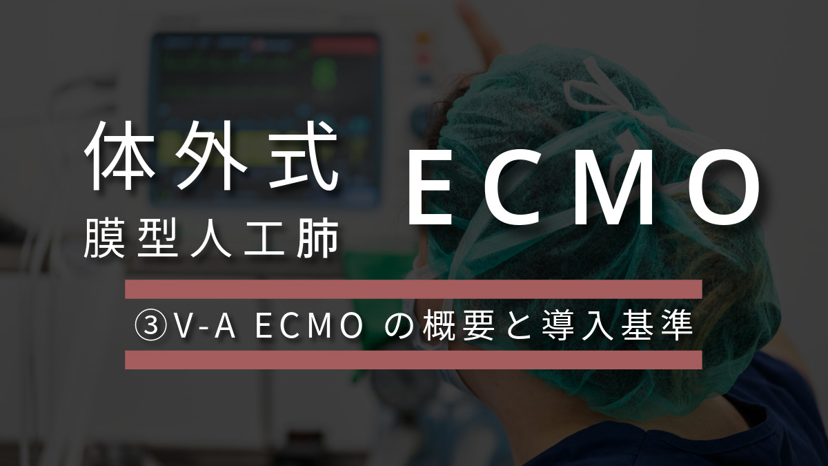 V-A ECMO の概要と導入基準 —Cardiac ECMOとは— | CEじゃーなる